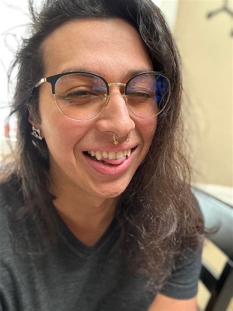 Finally Got My Fangs Done First Post R Bodymods