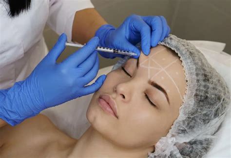 Understanding How Botox Works A Comprehensive Guide