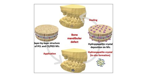 Sandwich Like Nanofibrous Scaffolds For Bone Tissue Regeneration Acs Applied Materials
