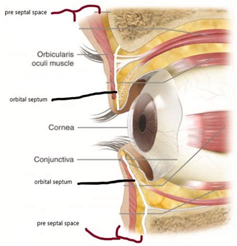 Mastering Minor Care Orbital Infections — Taming The Sru
