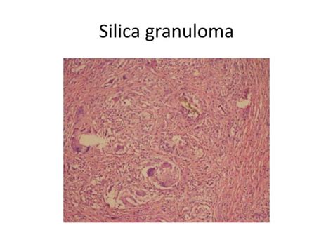 Polarizing Light Microscopy Pptx Physics Science