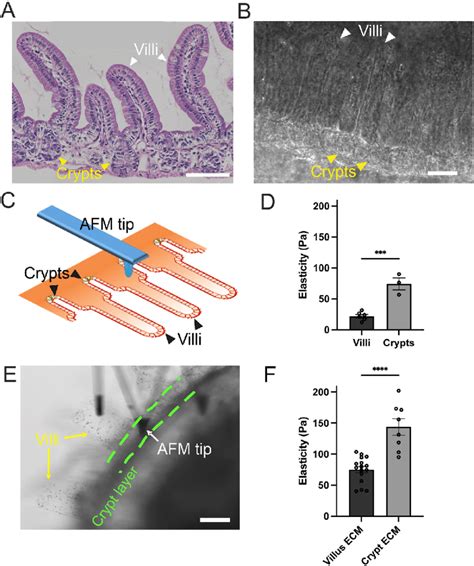 Stiffness Measurement Along The Crypt Villus Axis In Mouse Small