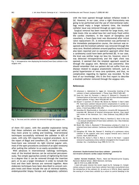 Pdf Ecomment Double Knotted Swan Ganz Catheter Potential For Non Invasive Ultrasonic