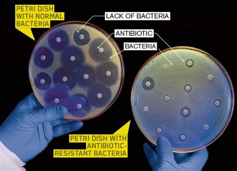 Resistant V S Non Resistant Bacteria