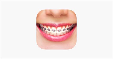 ‎fake Braces Face Photo Editor On The App Store