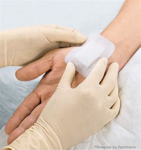 Превръзки на хирургични рани Сваляне на конци По домовете