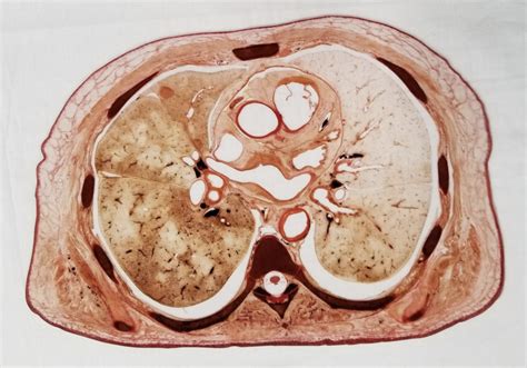Transverse Cross Section Exam 1 Diagram Quizlet