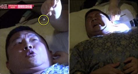 홍콩서 ‘귀 청소 받던 조세호 귀에서 나온 귀지 크기 동영상 포스트쉐어