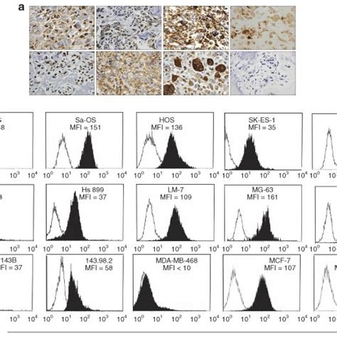 Primary Osteosarcomas And Osteosarcoma Cell Lines Express Human