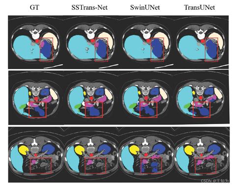 Sstrans Net Smart Swin Transformer Network For Medical Image Segmentation Csdn博客
