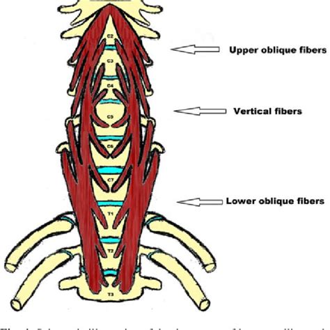 Pdf Acute Calcific Tendinitis Of The Longus Colli Muscle Case Report