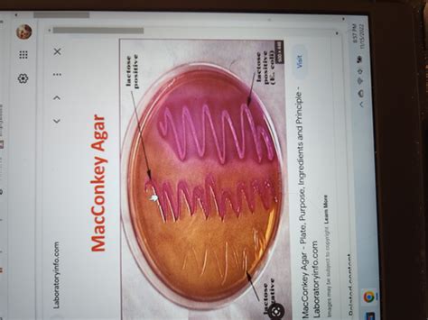 Microbiology Lab Flashcards Quizlet