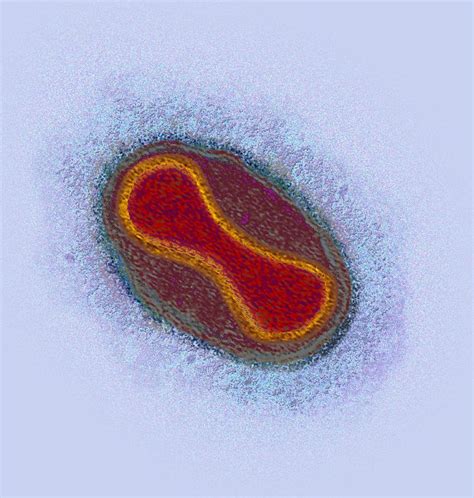 Smallpox Virus Particle Tem 1 By Ami Images Science Photo Library