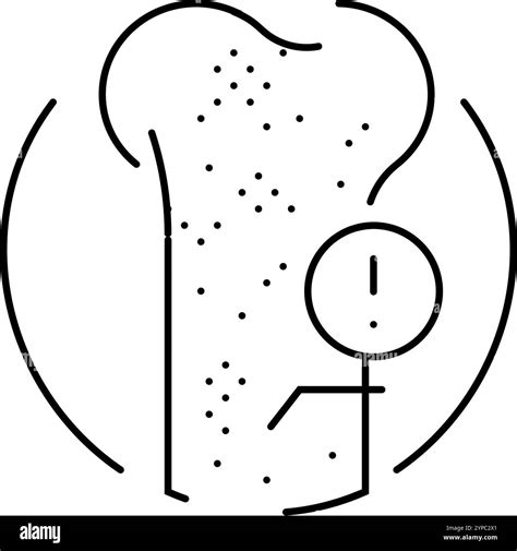Severe Osteoporosis Bone Line Icon Vector Illustration Stock Vector