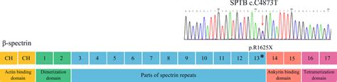 Sanger Sequencing Of The Pathogenic Sptb Cc4873t Mutation In Proband D