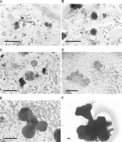 The Morphology Of A Cucumber Cell Suspension During The Induction Of