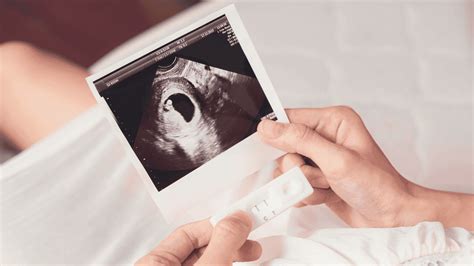 Gestational Sac In Early Pregnancy Meaning Growth And Risks Thomson