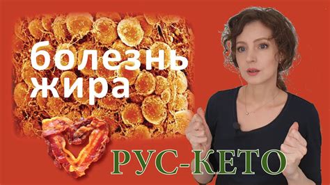 Ещё одна болезнь приводящая к ожирению Youtube