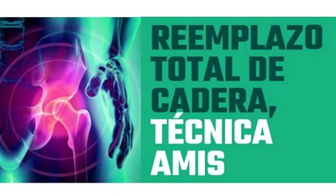 Reemplazo total de cadera técnica AMIS