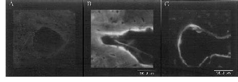 Figure 1 From Sensitive Detection Of Trace Aluminium In Biological Tissues By Confocal Laser