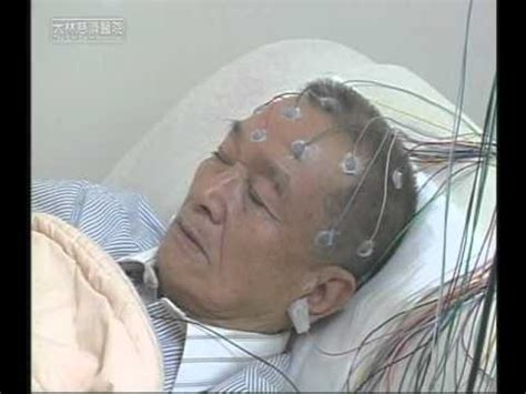 知情同意認識腦波圖 YouTube