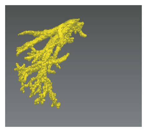 comparison of the improved fuzzy connectedness fc method with