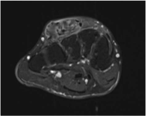 Contrast Enhanced Mri Download Scientific Diagram