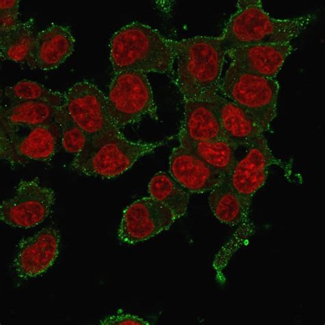 Tnf Alpha Tumor Necrosis Factor Alpha Monoclonal Antibody Pt2