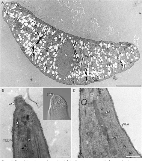 Figure 2 From Molecular Phylogeny Of Marine Gregarines Apicomplexa