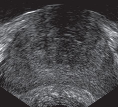 The History Of US From Bats And Boats To The Bedside And Beyond RSNA