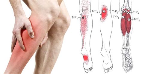Understanding Restless Legs Syndrome And Its Causes