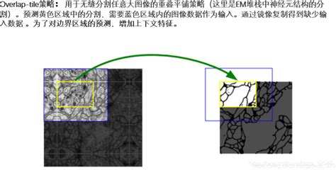 深度学习图像分割之unetunet图像分割 Csdn博客