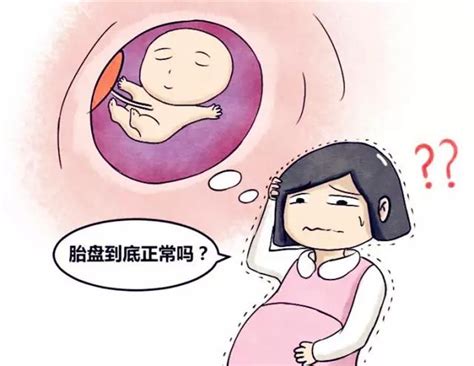 这种病是妊娠期严重并发症！如果想顺利生下宝宝，需要做到这6点 知乎
