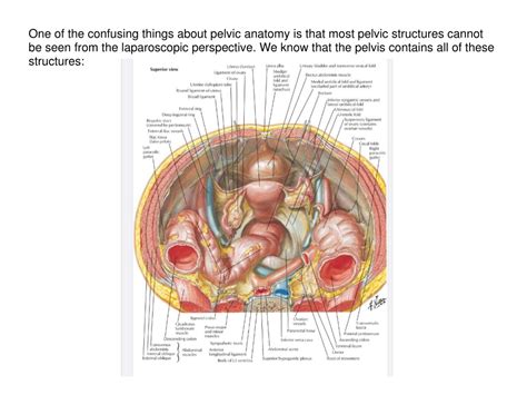 Ppt Pelvic Anatomy In Laparoscopic Surgery Powerpoint Presentation