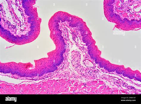 Flat Stratified Epithelium Photomicrograph X75 At 10 Cm Wide Stock