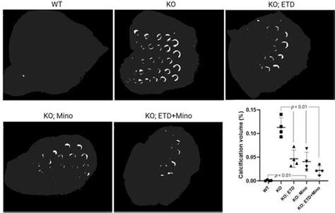 Novel Treatments For Pxe Targeting The Systemic And Local Drivers Of Ectopic Calcification