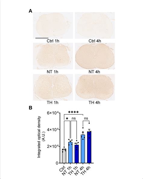 Figure Serum Non Specific Immunoglobin G Igg Leaked Into The Neural
