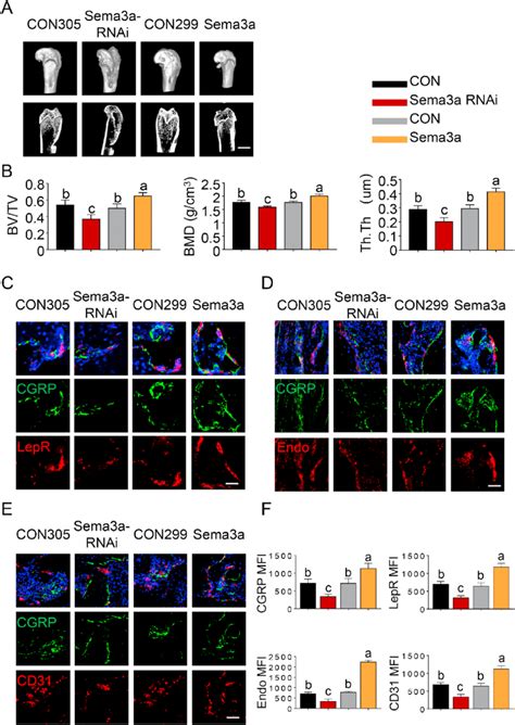 Sensory Nerve Derived Sema3a Promotes Osteogenesis And Angiogenesis In