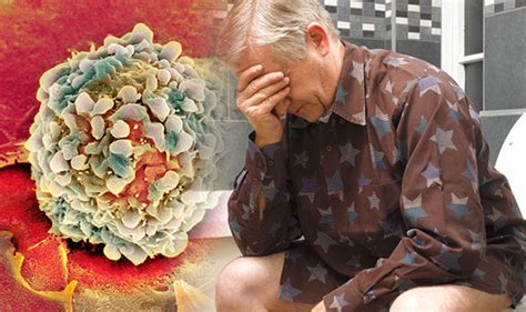 Bowel Cancer Symptoms And Signs Note Feeling The Need To Strain After