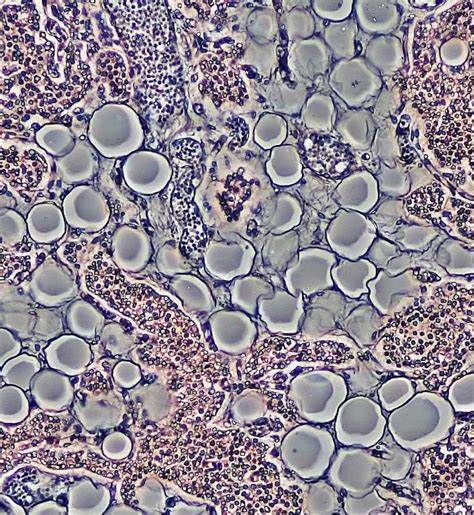 The Role Of Single Cell Omics In Infectious Disease Research And