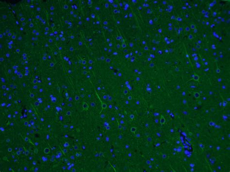 Alpha Tubulin Antibody 66031 1 Ig Proteintech