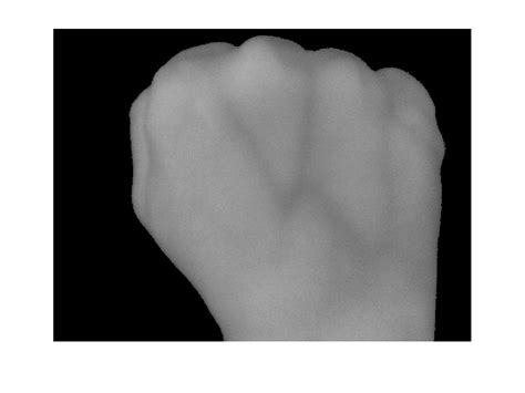 Matlabhow To Eleiminate The Black Background And Retain The Region Of