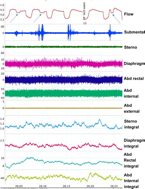 Representative Trace Of All Parameters Flow Raw Emgs And Integrated