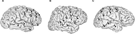 Figure 1 From Multivariate Autoregressive Models With Exogenous Inputs For Intracerebral