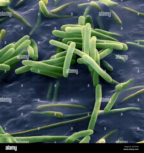 Bacillus Sphaericus Coloured Scanning Electron Micrograph Sem These