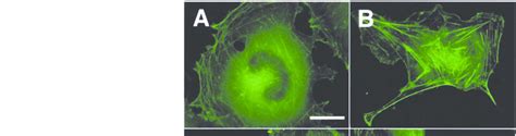 Expression Of Egfp β Actin In Cell Lines Of Different Tissue Origin