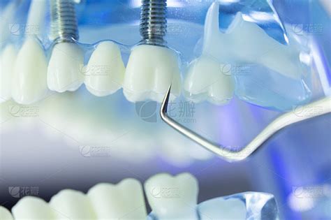牙齿口腔牙龈牙医教学模型