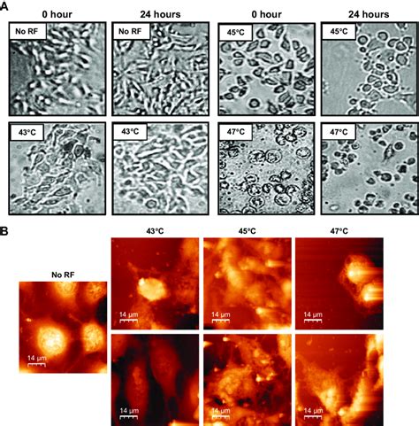 A Optical Microscopic Images 100× Of B16f1 Cells At 0 Hours And 24