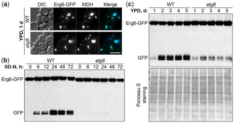 Nitrogen Starvation And Stationary Phase Lipophagy Have Distinct