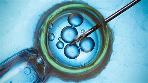 Anti Müllerian Hormone Amh And Fertility Assessment Technology Networks